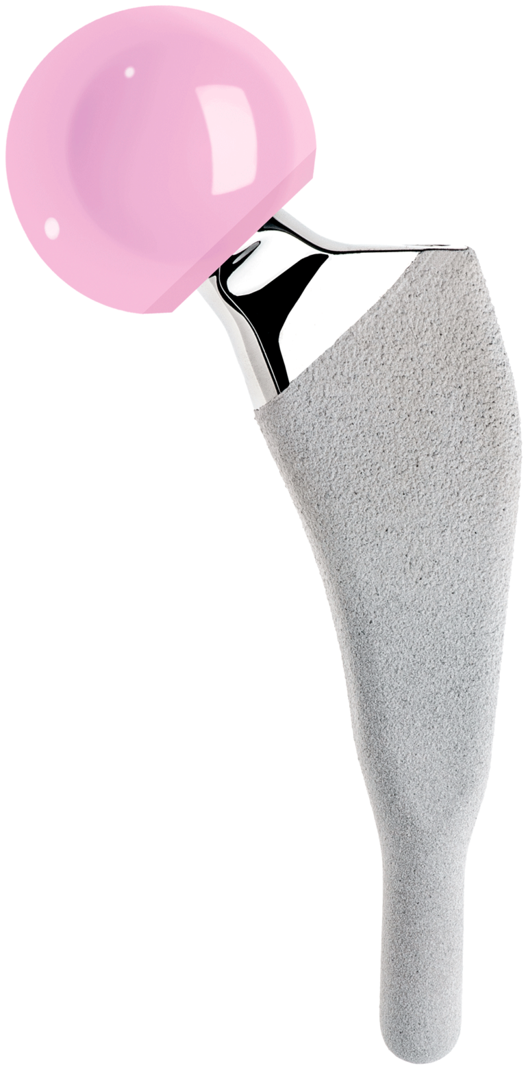 Prótesis de cadera | Recuperación y cirugía de reemplazo de cadera